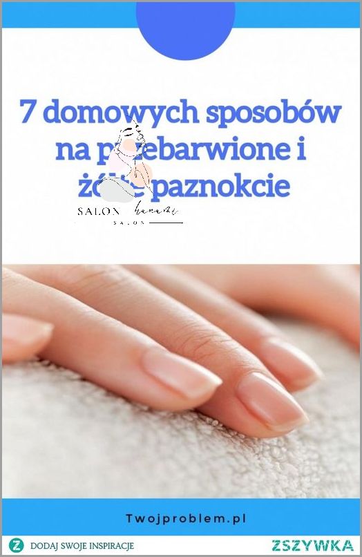 7 Domowych Sposobów Na Nagniotki! - [Zaktualizowano maj 2026 ...